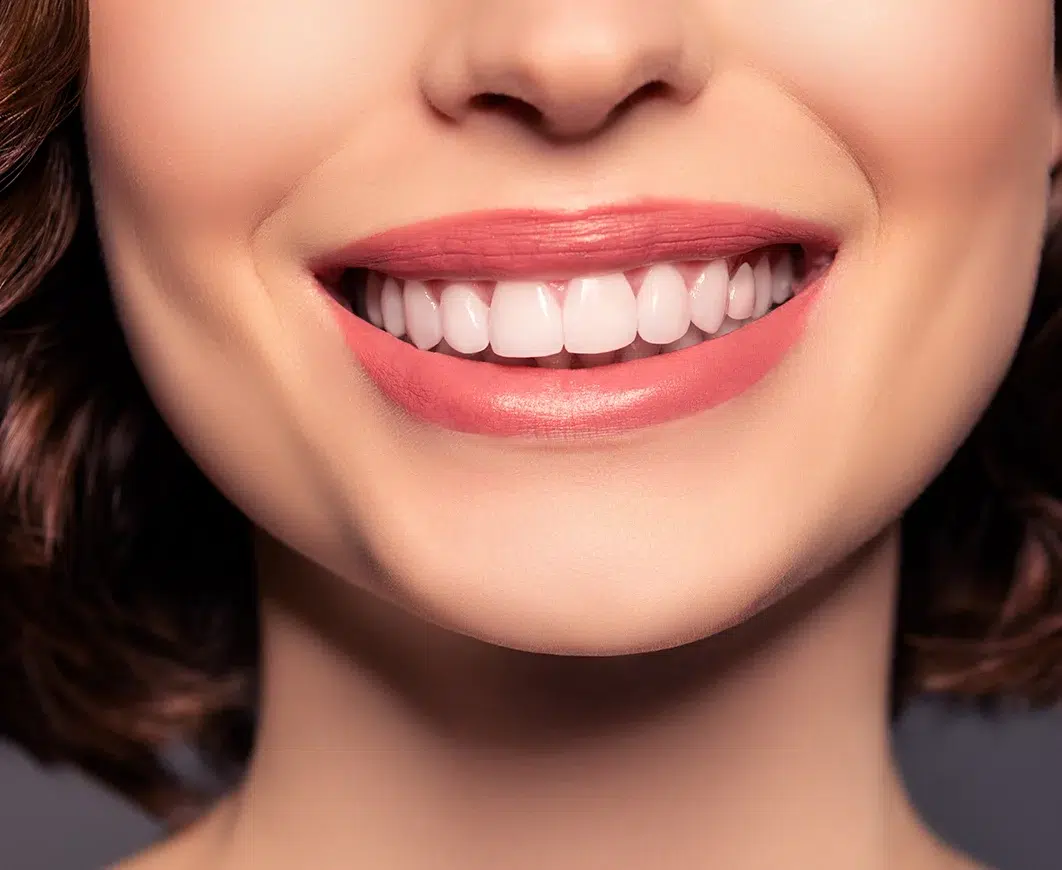 Enhance Your Smile with Dental Veneers in Austin